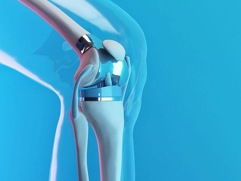 Medical Device Coatings | PCI Magazine